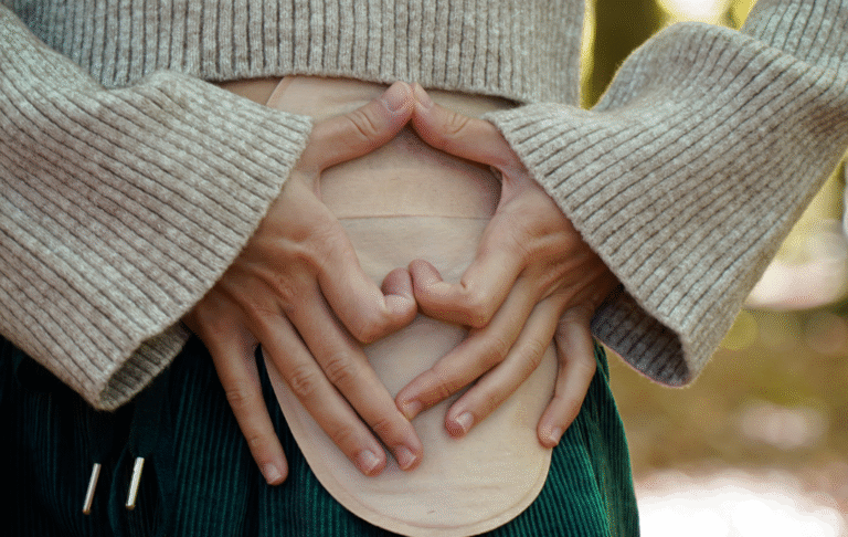 Handen vol Steun voor iedereen met een stoma of pouch - Stichting ...